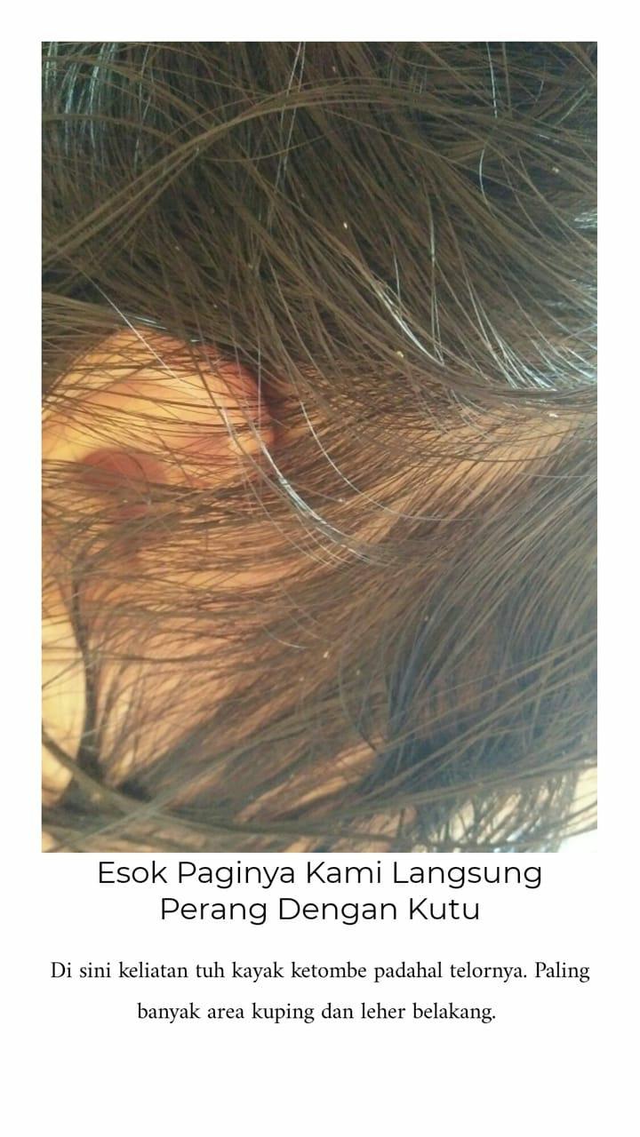 Cara Hilangin Kutu Rambut Nih! — Travel Diary of Lenny Lim